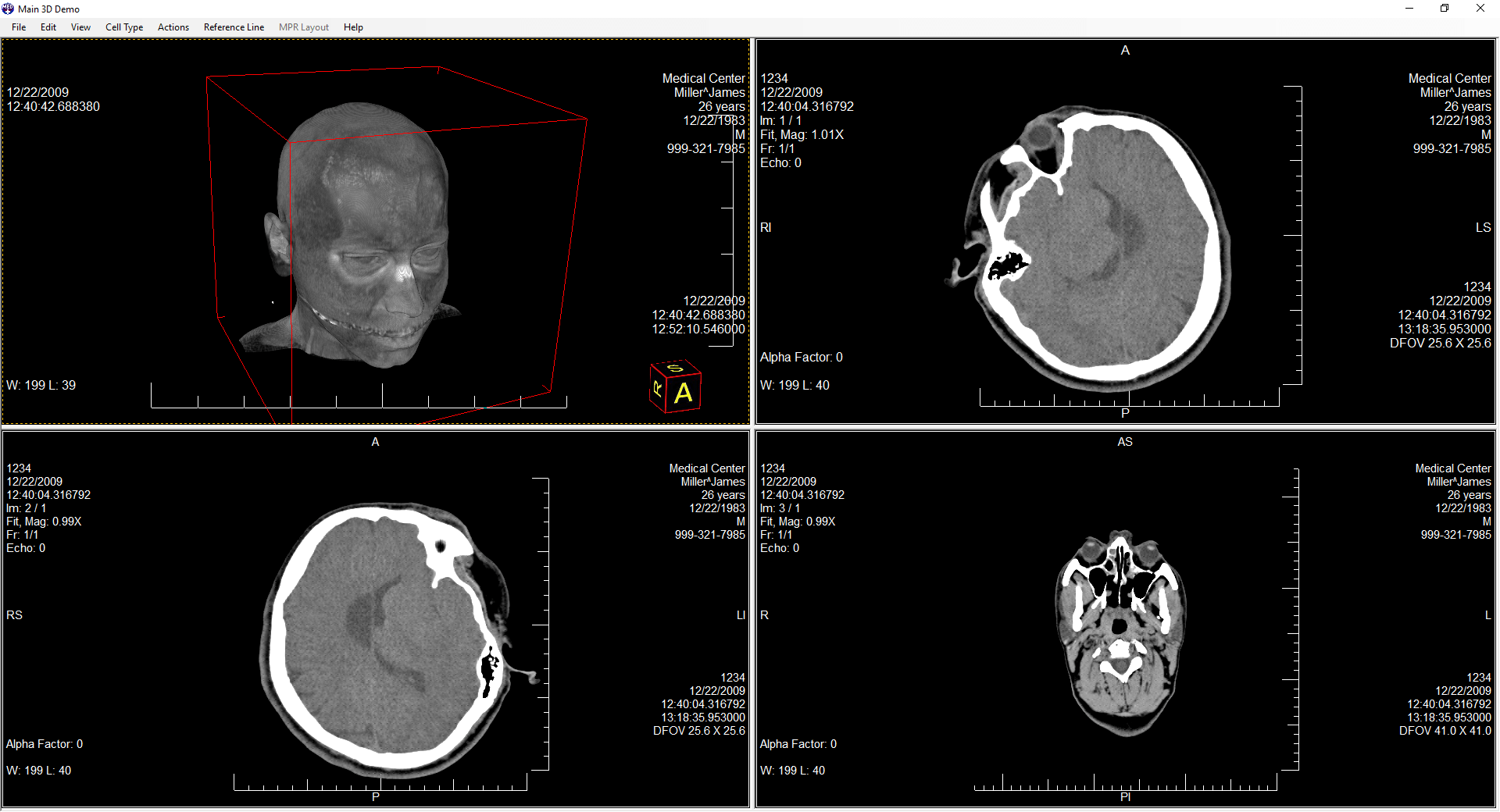 Medical 3D SDK Technology | LEADTOOLS