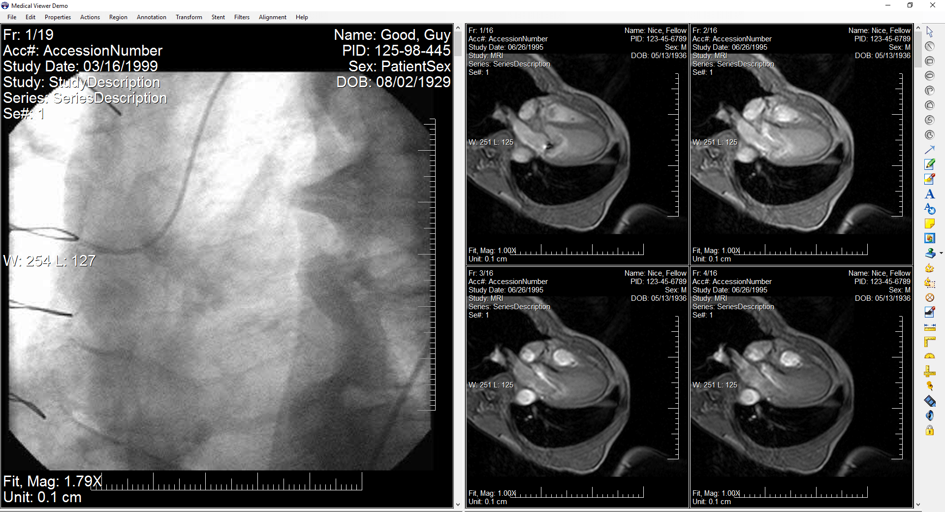 Medical Image Display Sdk Technology Leadtools